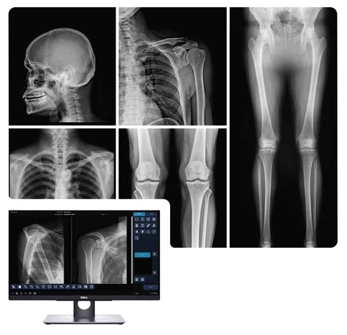 De,works Digital Radiography